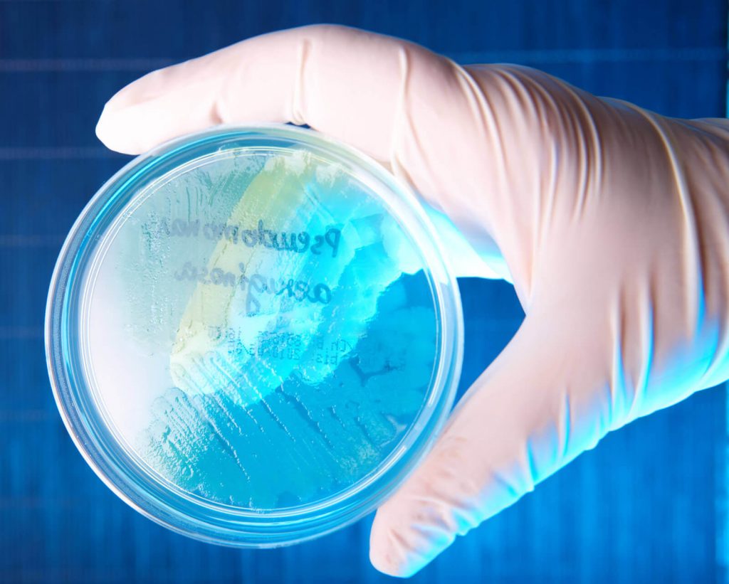 Swimming Pool & Spa Pool Water Testing | UKAS Lab Analysis | Feedwater ...